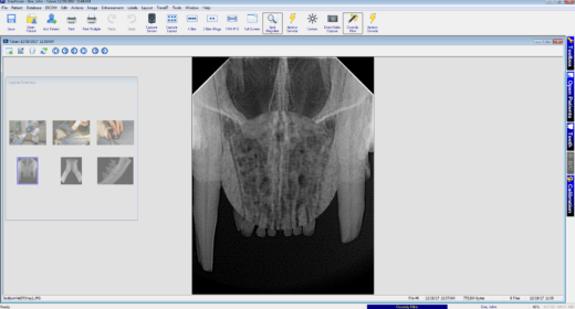 X-Ray Vision Imaging