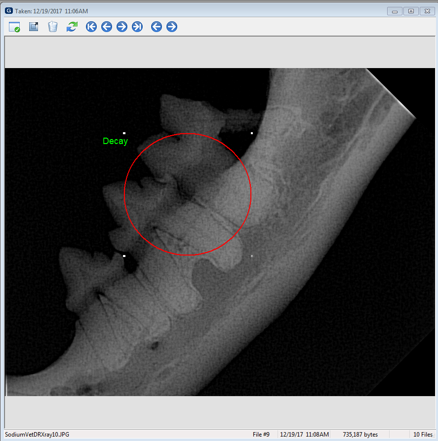 X-Ray Vision Imaging